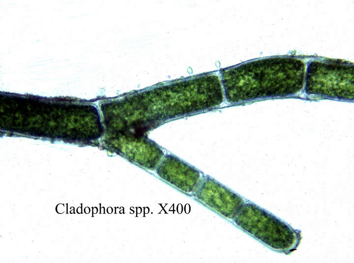 Cladophora Algae Under Microscope